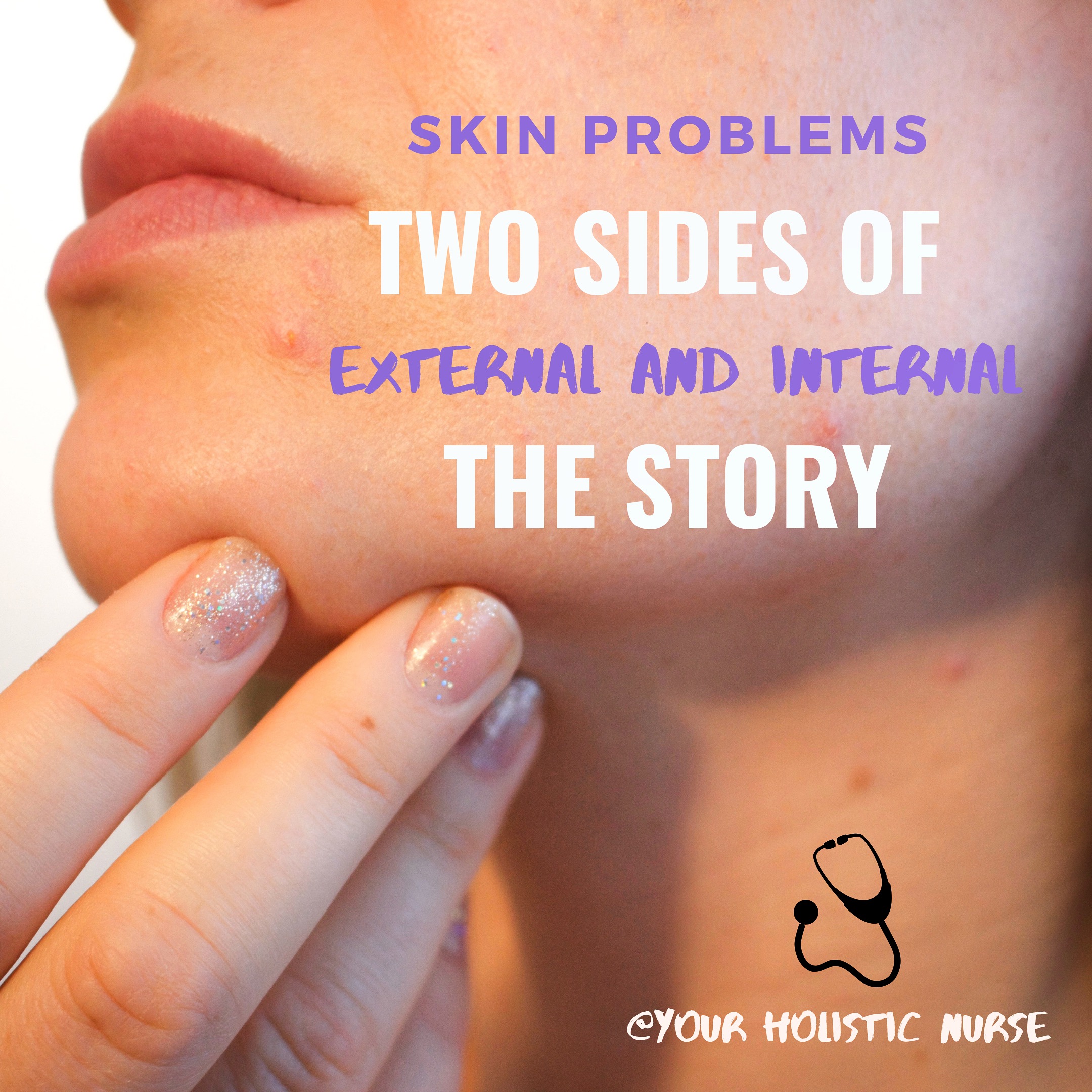 The Two Sided Skin Story – Holistic RI • Integrative Medicine